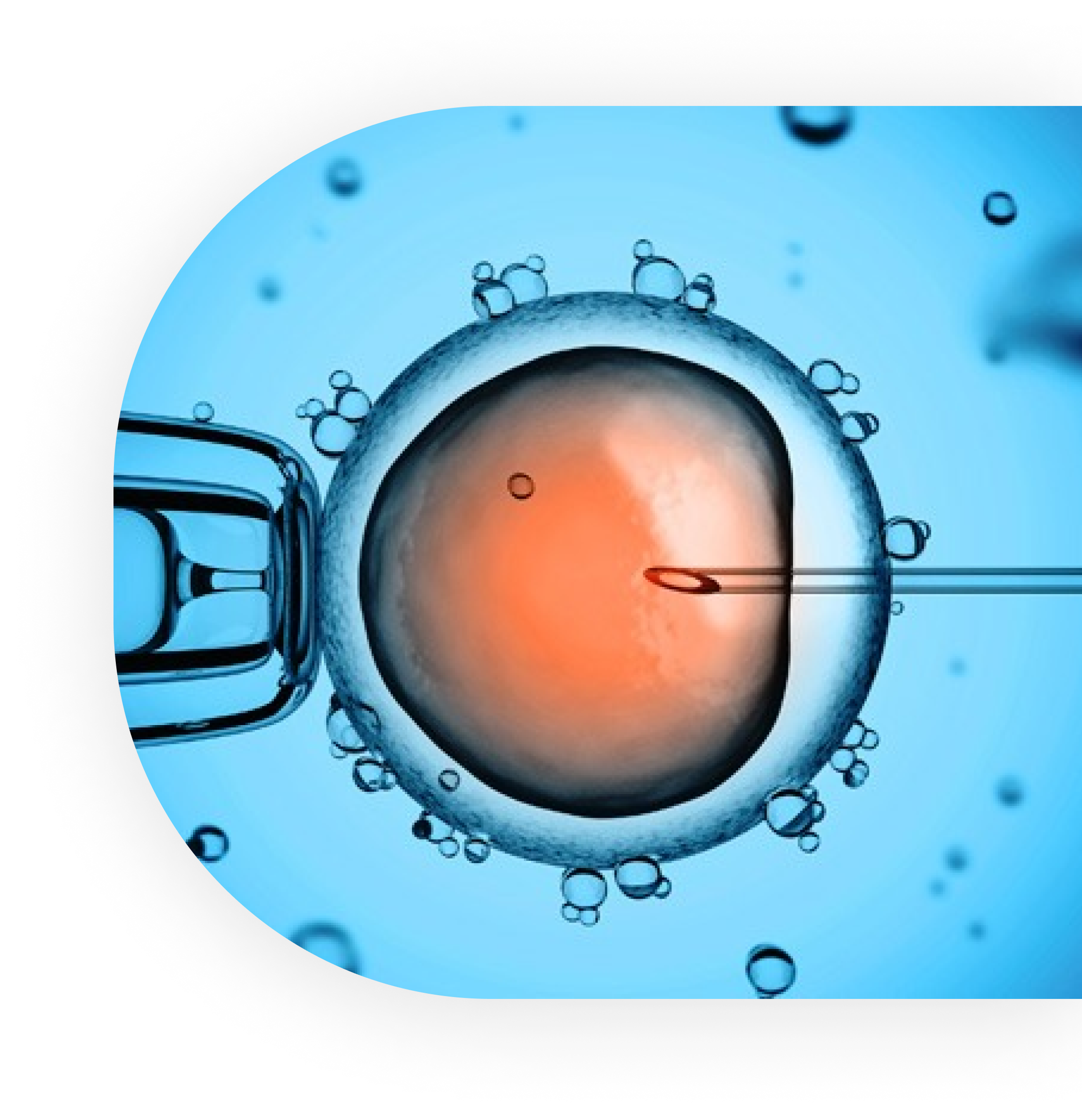 Prof. Consultz International Limited | Nigeria's Reliable Medical IVF ...